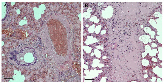 Fatal Interstitial Pneumonia Associated with Bovine Coronavirus in Cows ...