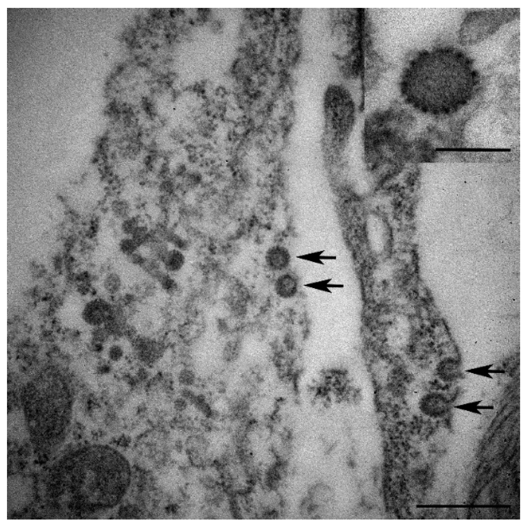 First Evidence of Carp Edema Virus Infection of Koi Cyprinus carpio in ...