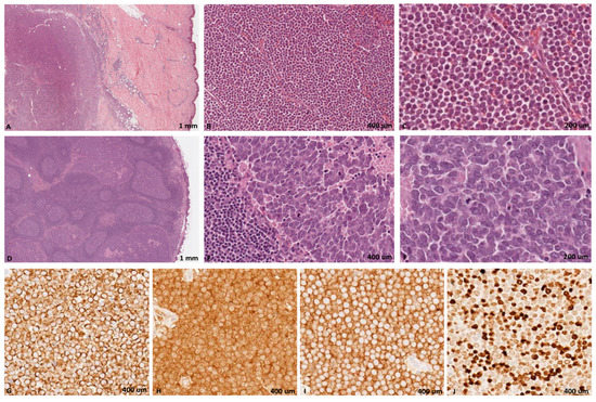 Evaluation of Merkel Cell Polyomavirus DNA in Tissue Samples from ...