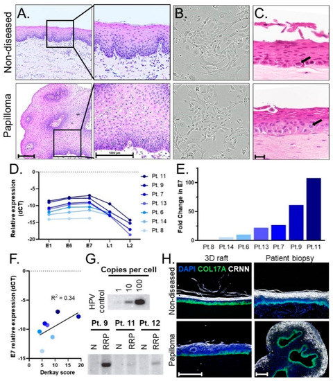 Patient-Derived Organotypic Epithelial Rafts Model Phenotypes in ...