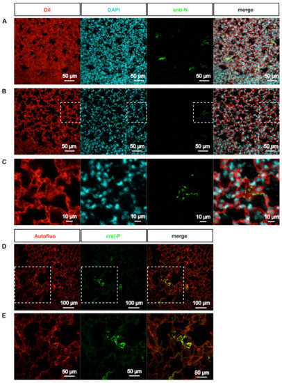 New Look at RSV Infection: Tissue Clearing and 3D Imaging of the Entire ...