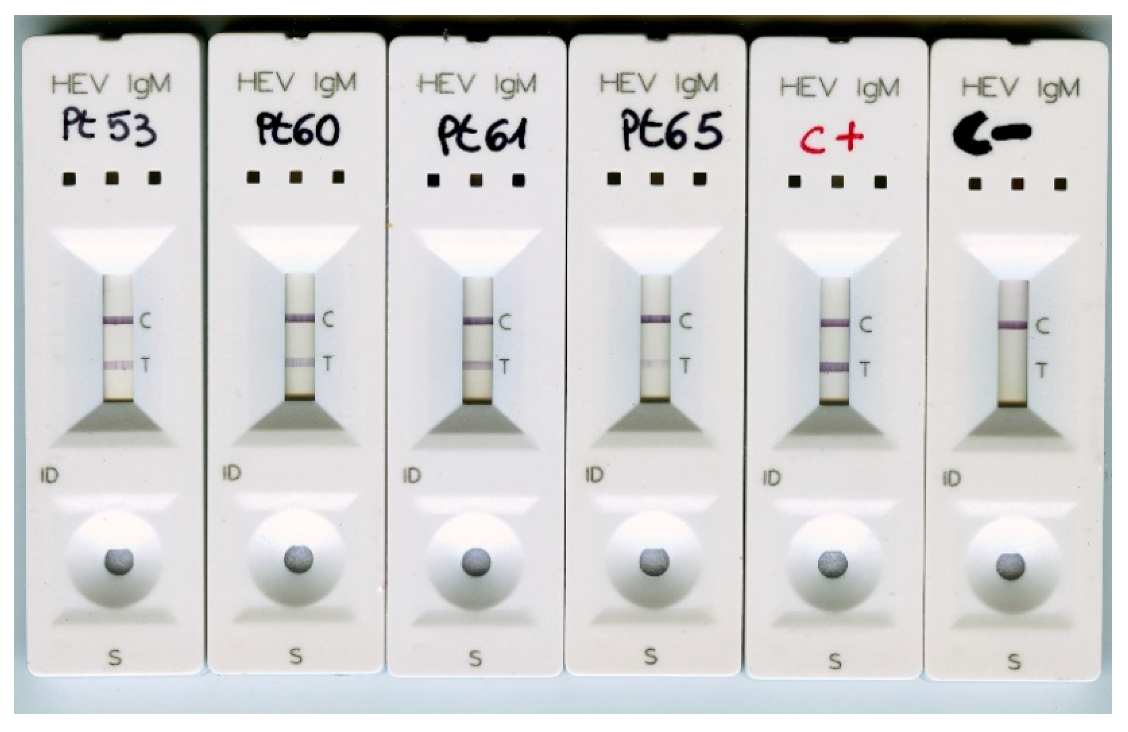 Anti-HEV IgG Avidity Testing: Utility for Diagnosing Acute and Resolved ...