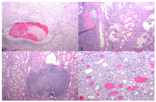 Caprine Arthritis Encephalitis Virus Is Associated with Renal Lesions