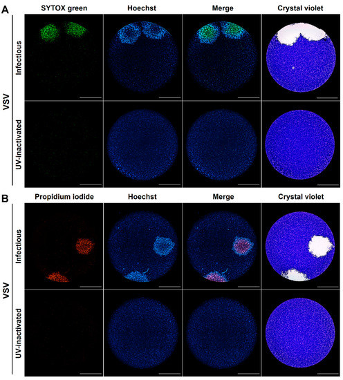 A Fluorescent Real-Time Plaque Assay Enables Single-Cell Analysis of ...