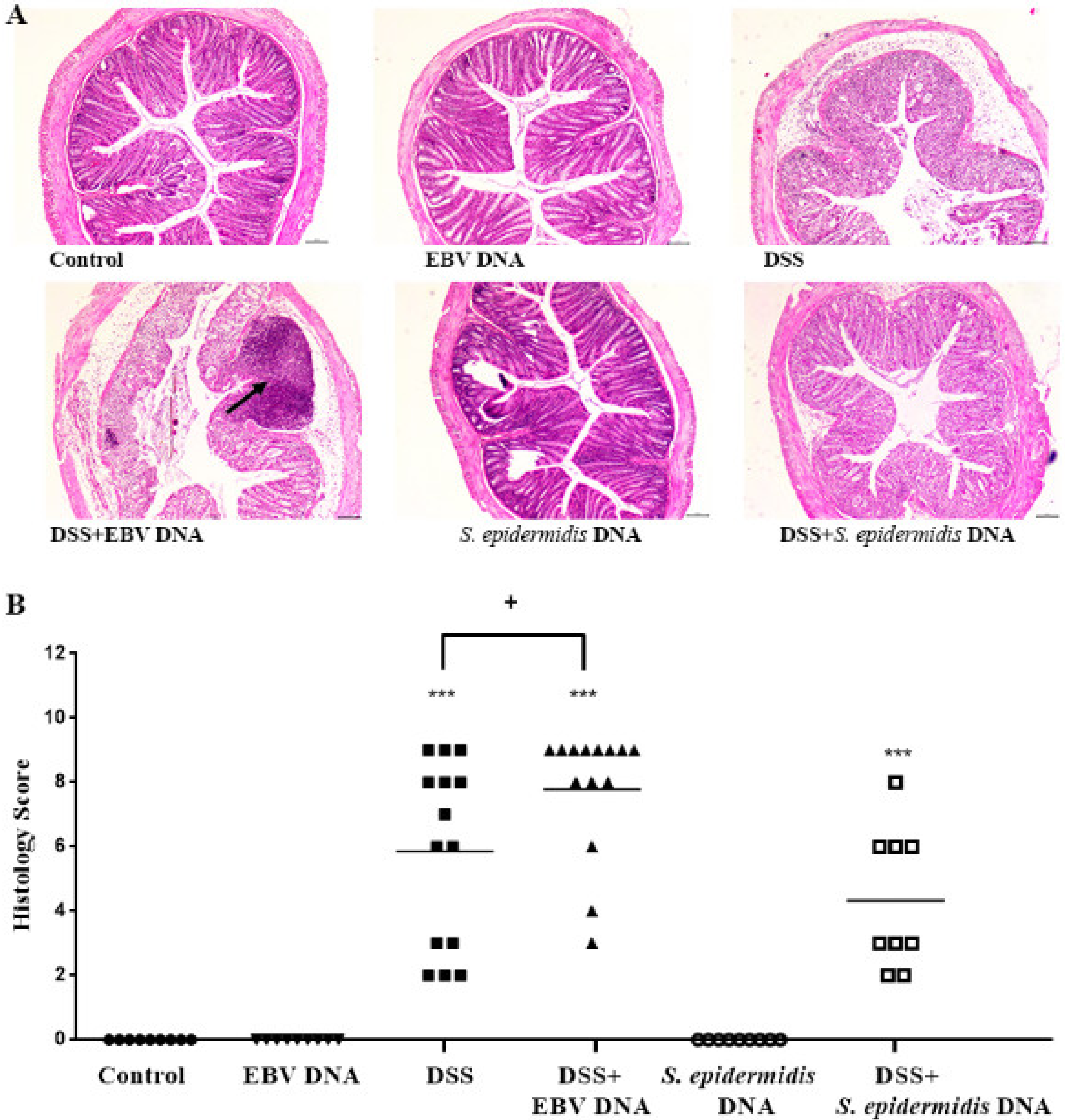 Epstein–Barr Virus DNA Exacerbates Colitis Symptoms in a Mouse Model of ...