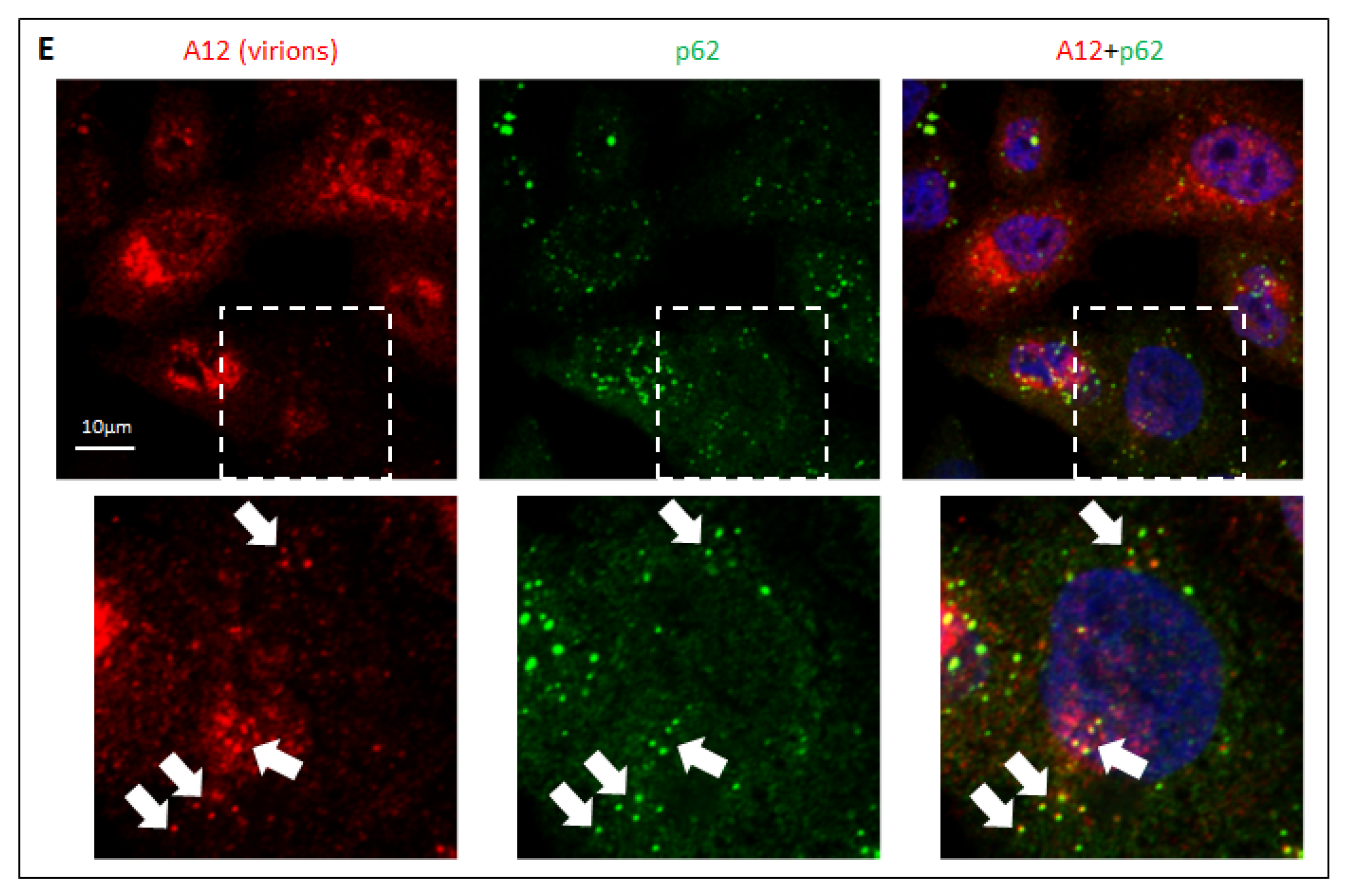 Interaction of Poliovirus Capsid Proteins with the Cellular Autophagy ...
