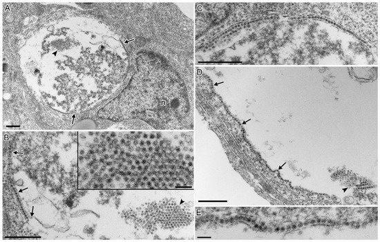 Viruses | Special Issue : Fish Virus