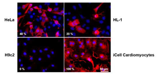In Vitro Model Systems of Coxsackievirus B3-Induced Myocarditis ...