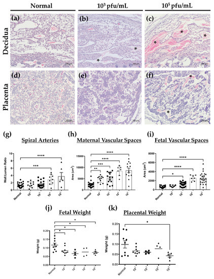 Primary HSV-2 Infection in Early Pregnancy Results in Transplacental ...