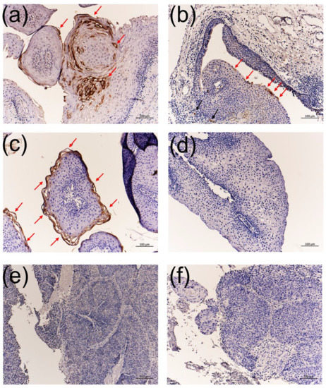 Development of Antibodies against HPV-6 and HPV-11 for the Study of ...