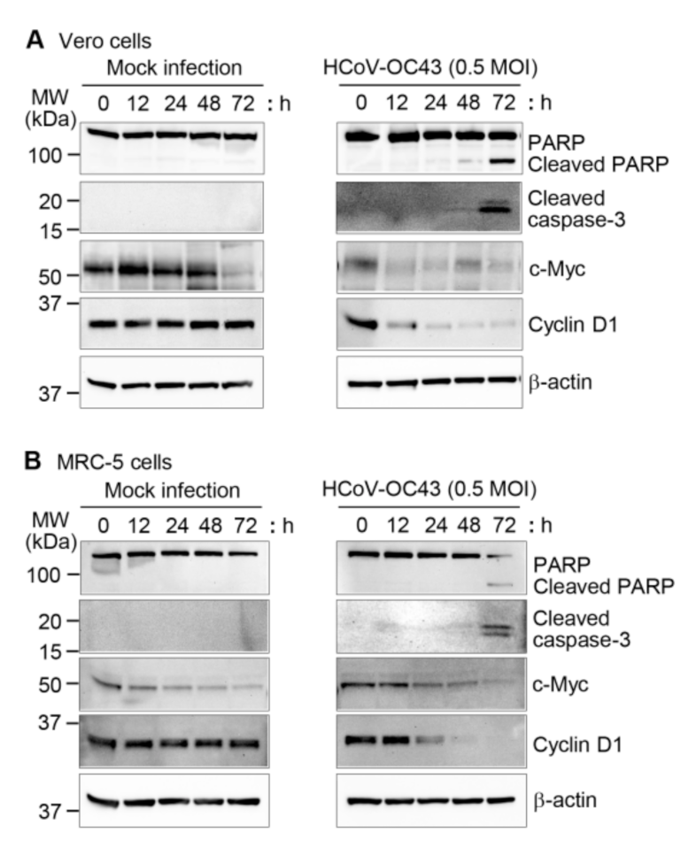 Apoptosis Enhances the Replication of Human Coronavirus OC43