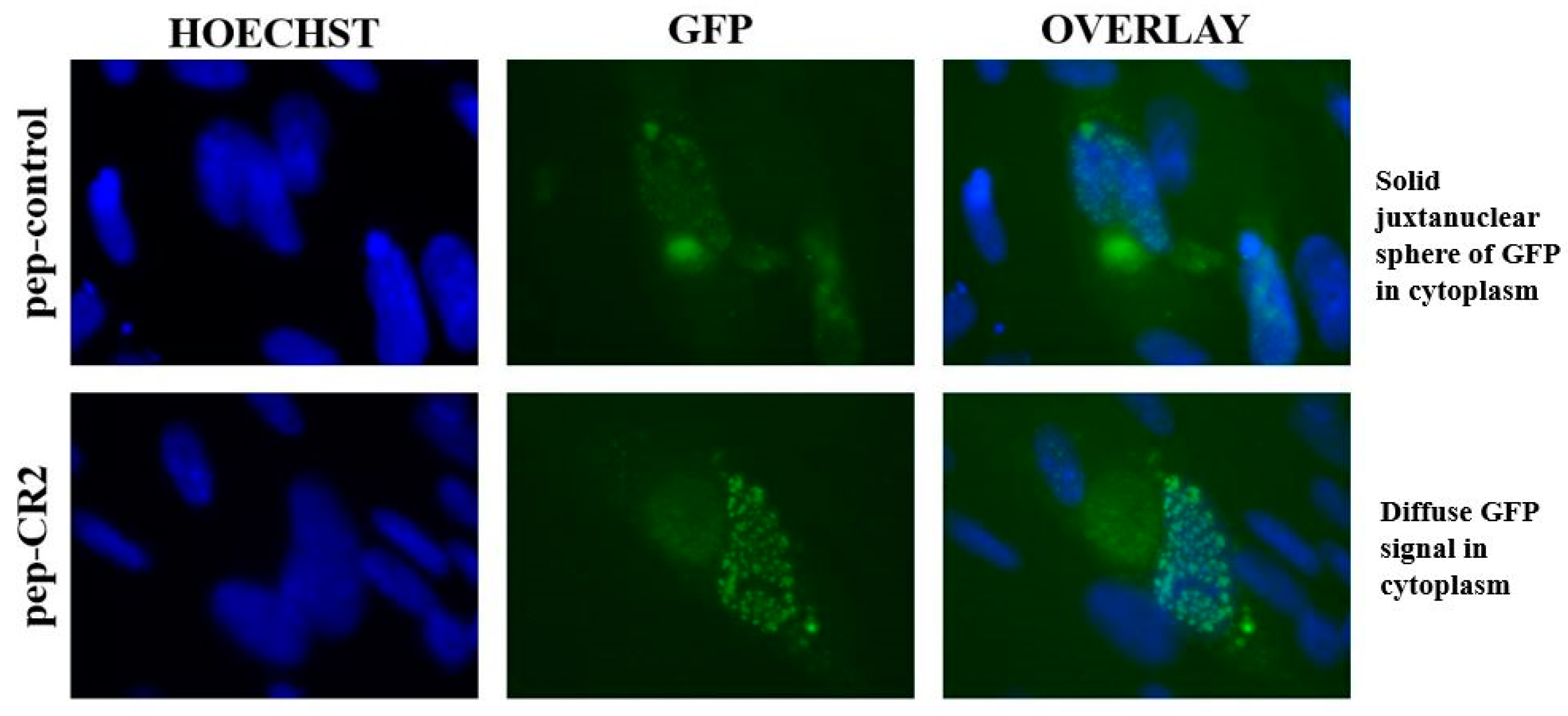 Tegument Protein pp150 Sequence-Specific Peptide Blocks Cytomegalovirus ...