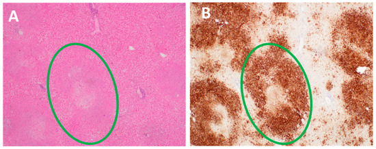 Viruses | Free Full-Text | Distinguishing Features Common to Dual Fatal ...