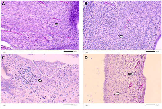 Infection with IBV DMV/1639 at a Young Age Leads to Increased Incidence ...