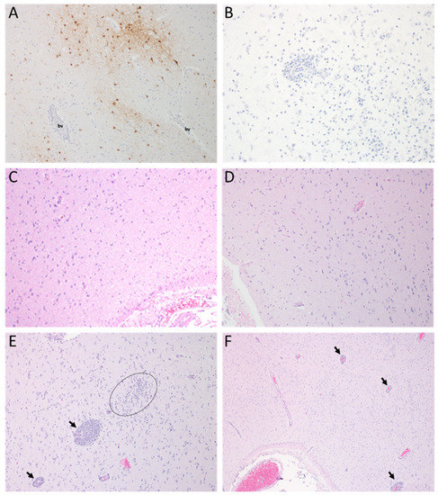 Efficacy of Western, Eastern, and Venezuelan Equine Encephalitis (WEVEE ...