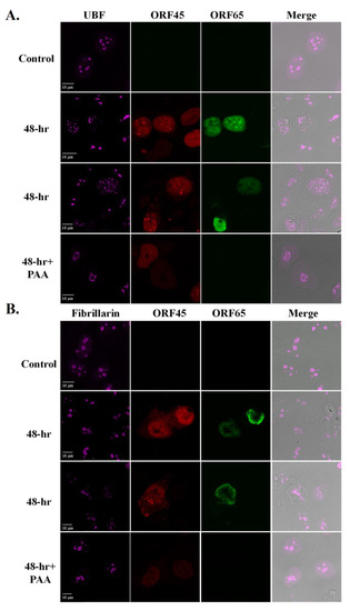 Viruses | Free Full-Text | Lytic Reactivation of the Kaposi’s Sarcoma-Associated Herpesvirus ...