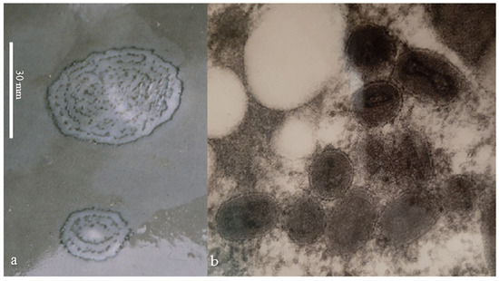 Detection of Cetacean Poxvirus in Peruvian Common Bottlenose Dolphins ...