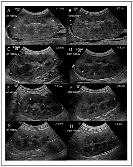 Clinical Follow-Up and Postmortem Findings in a Cat That Was Cured of ...