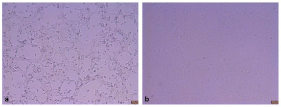Isolation, Identification, and Genetic Phylogenetic Analysis of Two ...