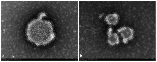 Isolation, Identification, and Genetic Phylogenetic Analysis of Two ...