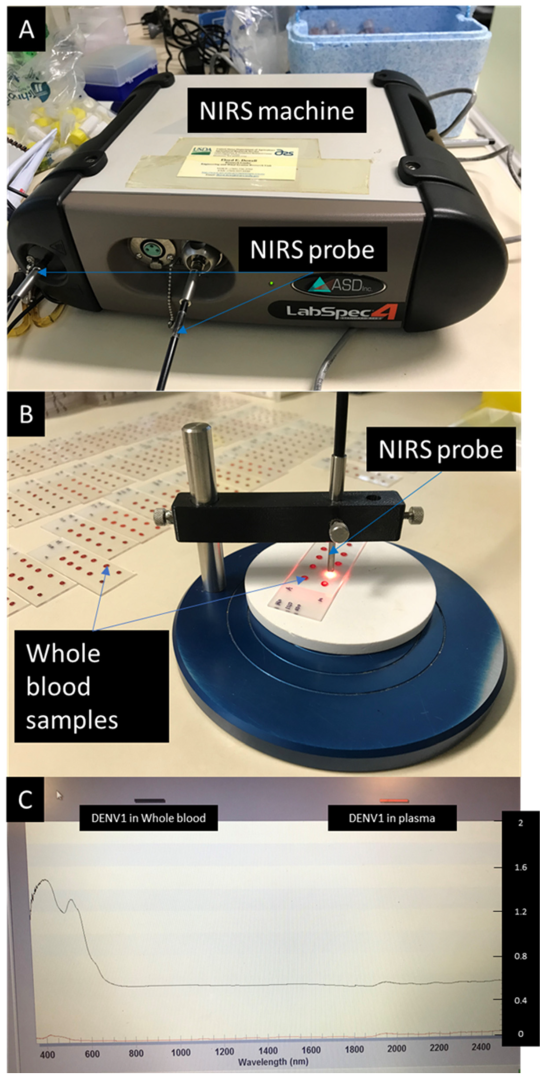 First Report of the Detection of DENV1 in Human Blood Plasma with Near ...