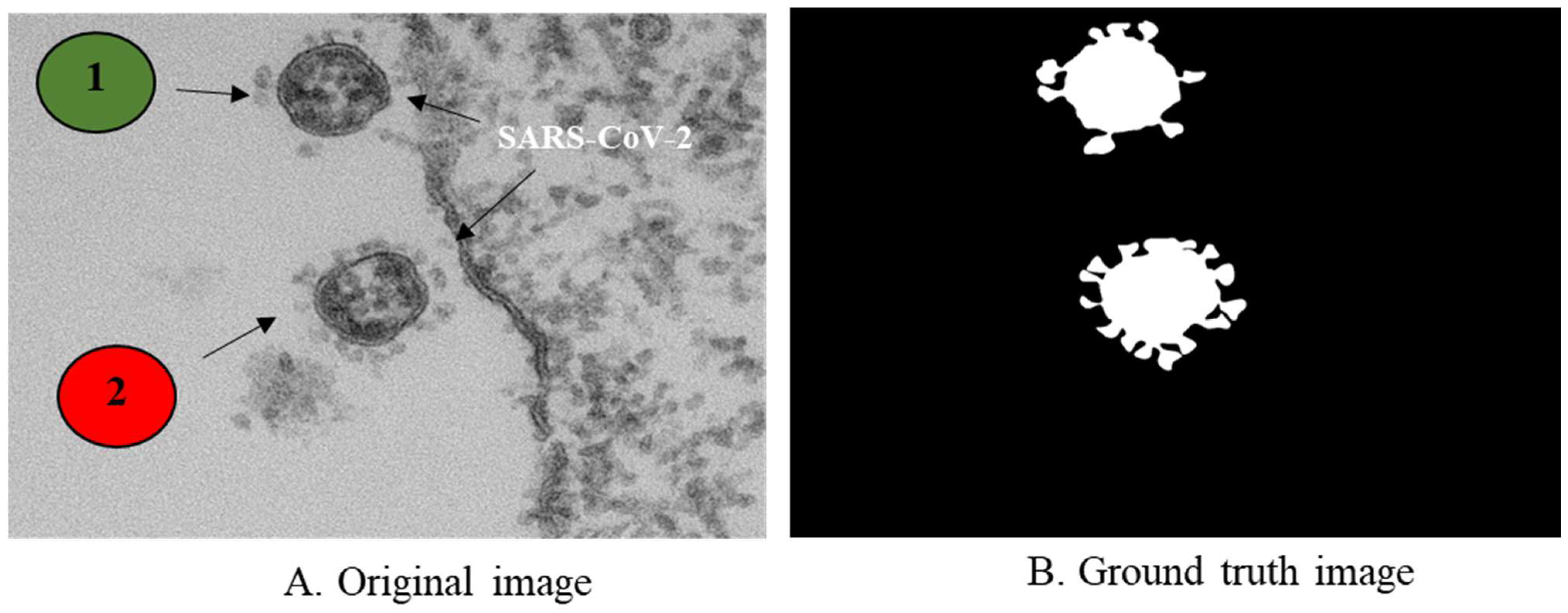 SARS-CoV-2 Morphometry Analysis and Prediction of Real Virus Levels Based on Full Recurrent ...