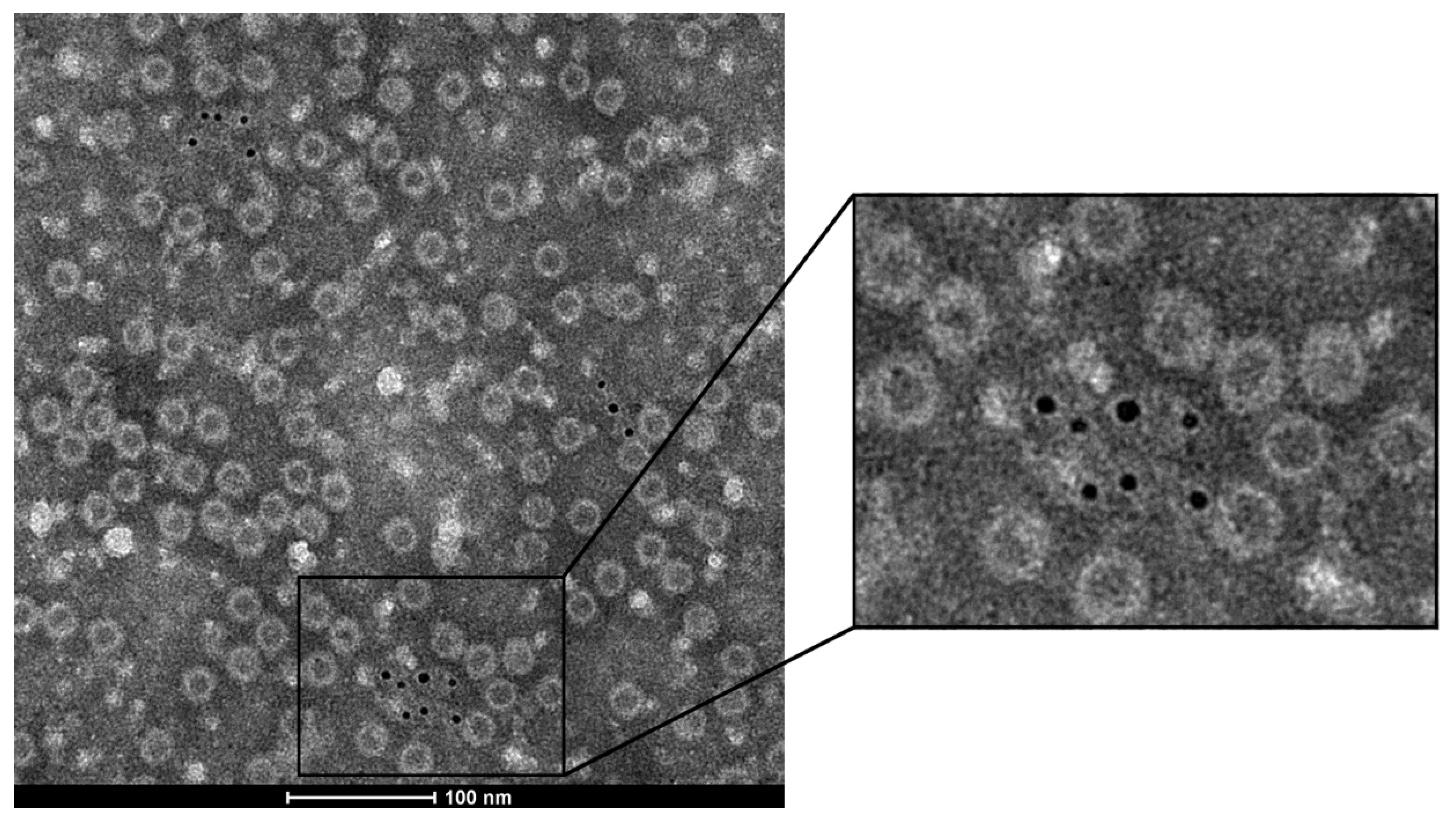 Recombinant Virus-like Particles of Human Parvovirus B19 with the ...