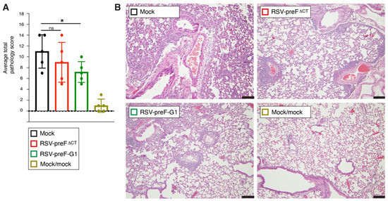Enhancing Anti-G Antibody Induction by a Live Single-Cycle Prefusion F ...