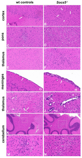 Suppressor of Cytokine Signalling 5 (SOCS5) Modulates Inflammatory ...