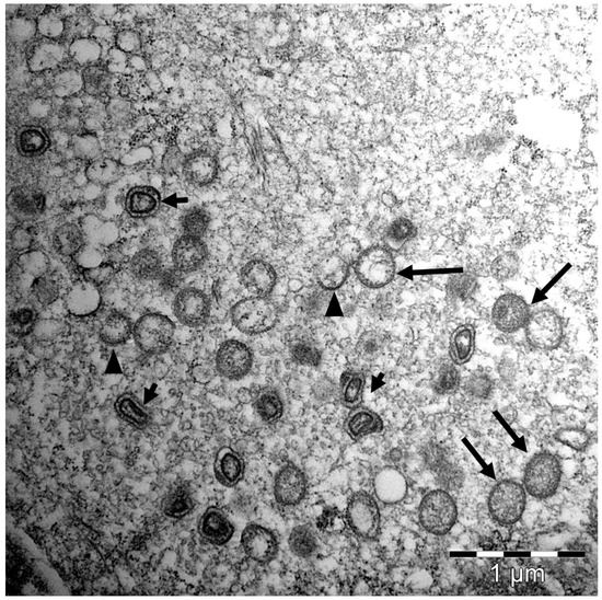 Emergence of Salmon Gill Poxvirus