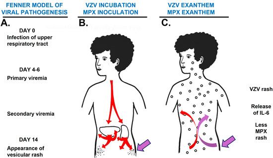 Reassessment of Evidence about Coinfection of Chickenpox and Monkeypox ...