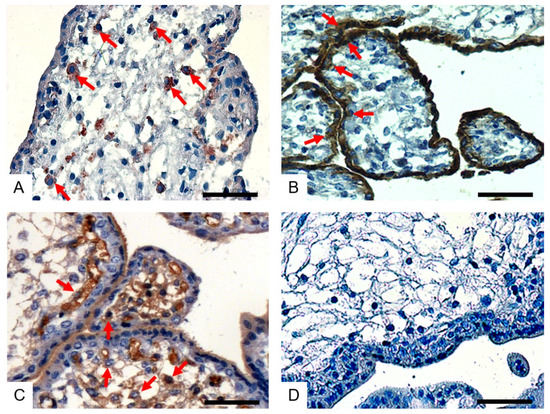 Tropism and Infectivity of Pandemic Influenza A H1N1/09 Virus in the ...