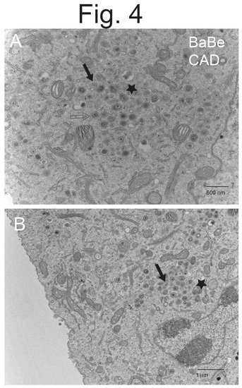 Pseudorabies Virus Mutants Lacking US9 Are Defective in Cytoplasmic ...
