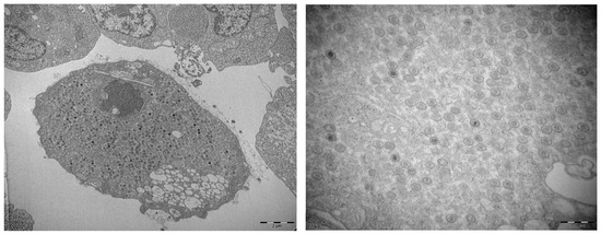 Isolation, Characterization, and Transcriptome Analysis of an ISKNV-Like Virus from Largemouth Bass