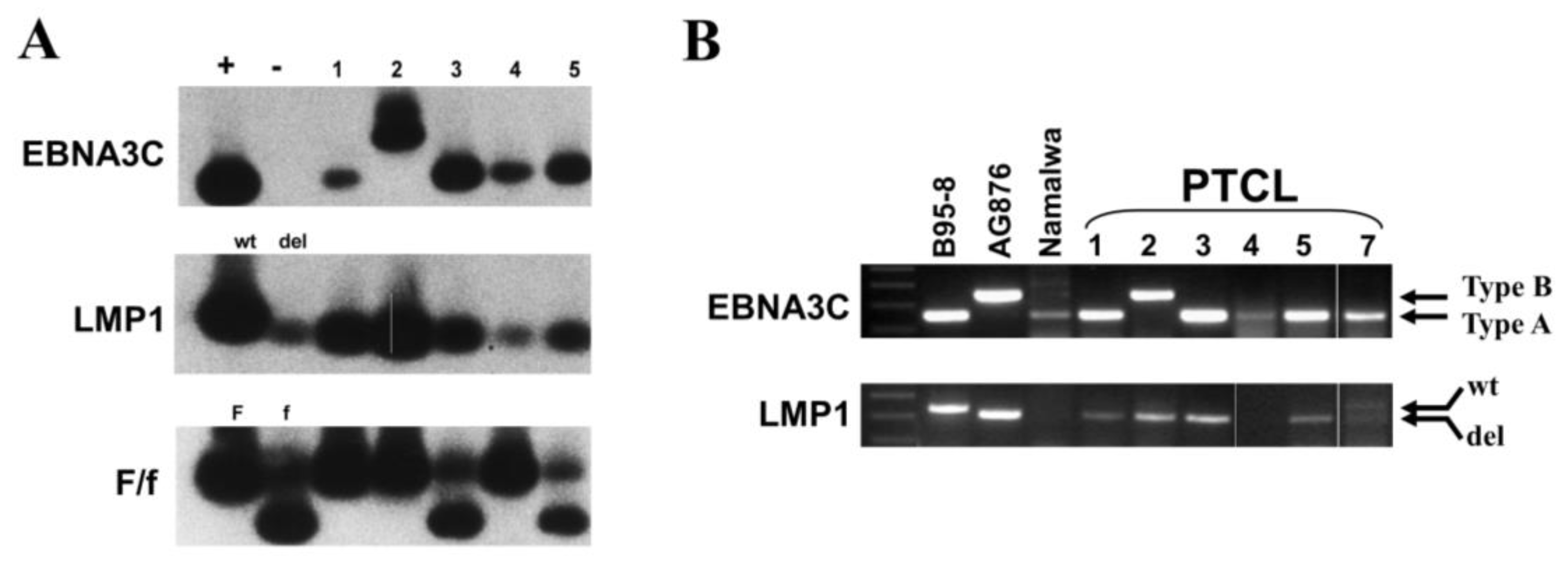 Comprehensive Profiling of EBV Gene Expression and Promoter Methylation ...