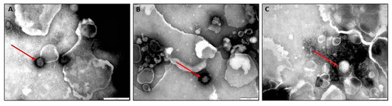 Experimental Infection of Domestic Pigs (Sus scrofa) with Rift Valley ...