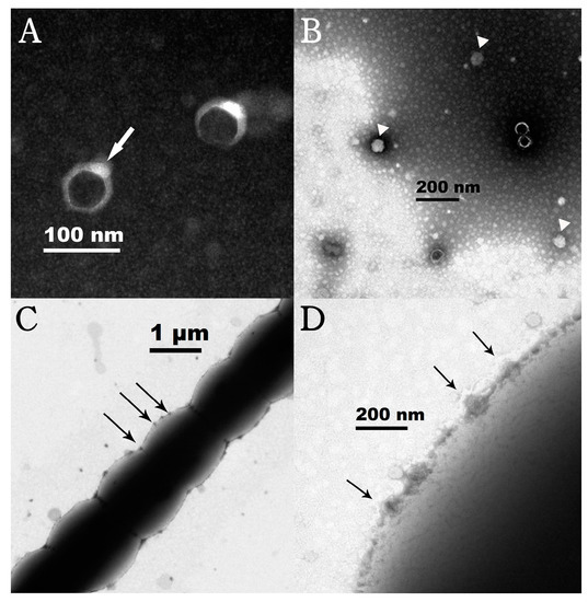 Genomic Analysis of a New Freshwater Cyanophage Lbo240-yong1 Suggests a ...