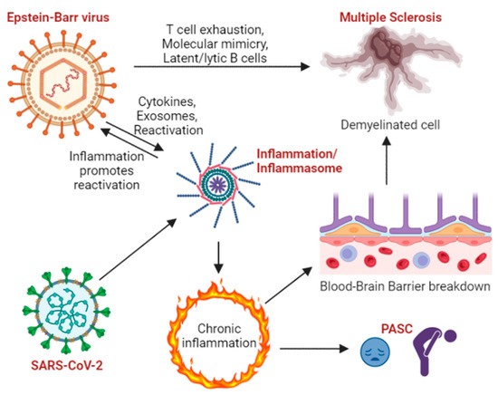 Viruses | Free Full-Text | Inflammation and Epstein–Barr Virus at the Crossroads of Multiple ...