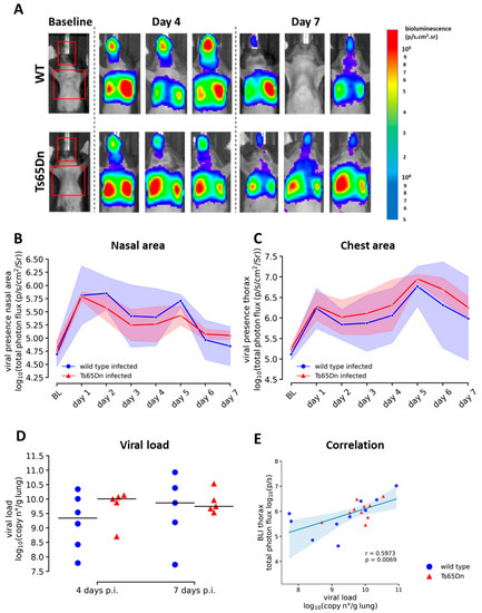 A Multimodal Imaging-Supported Down Syndrome Mouse Model of RSV Infection