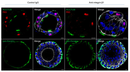 Apical-Out Human Airway Organoids Modeling SARS-CoV-2 Infection