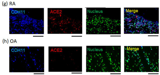 Tumor Necrosis Factor and Interleukin-1β Upregulate NRP2 Expression and ...