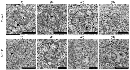 Viruses | Free Full-Text | Ultrastructural and Functional ...
