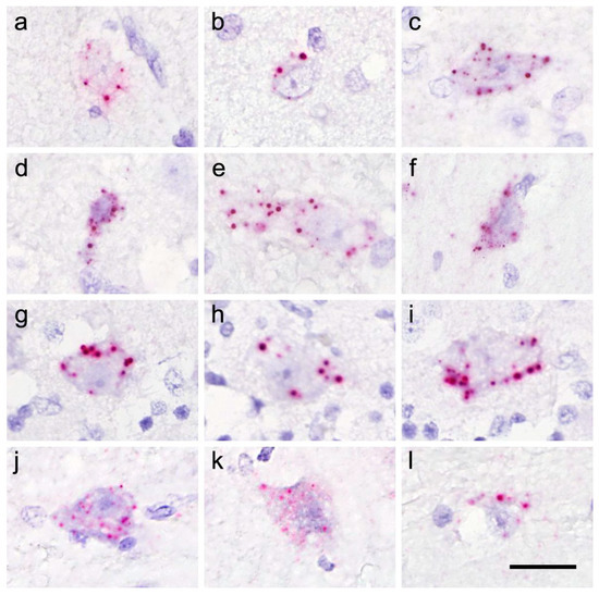 Rustrela Virus-Associated Encephalomyelitis (‘Staggering Disease’) in ...