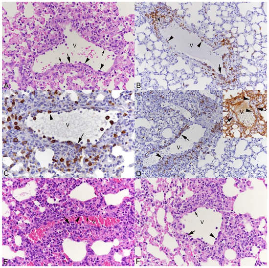 The Stereotypic Response of the Pulmonary Vasculature to Respiratory ...