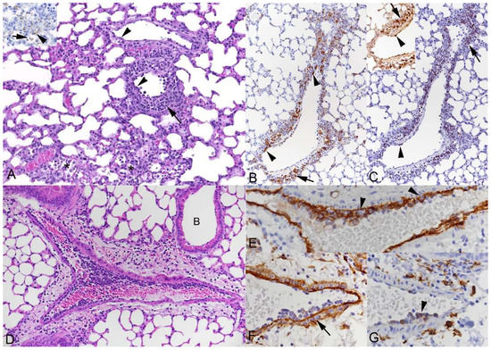 The Stereotypic Response of the Pulmonary Vasculature to Respiratory ...