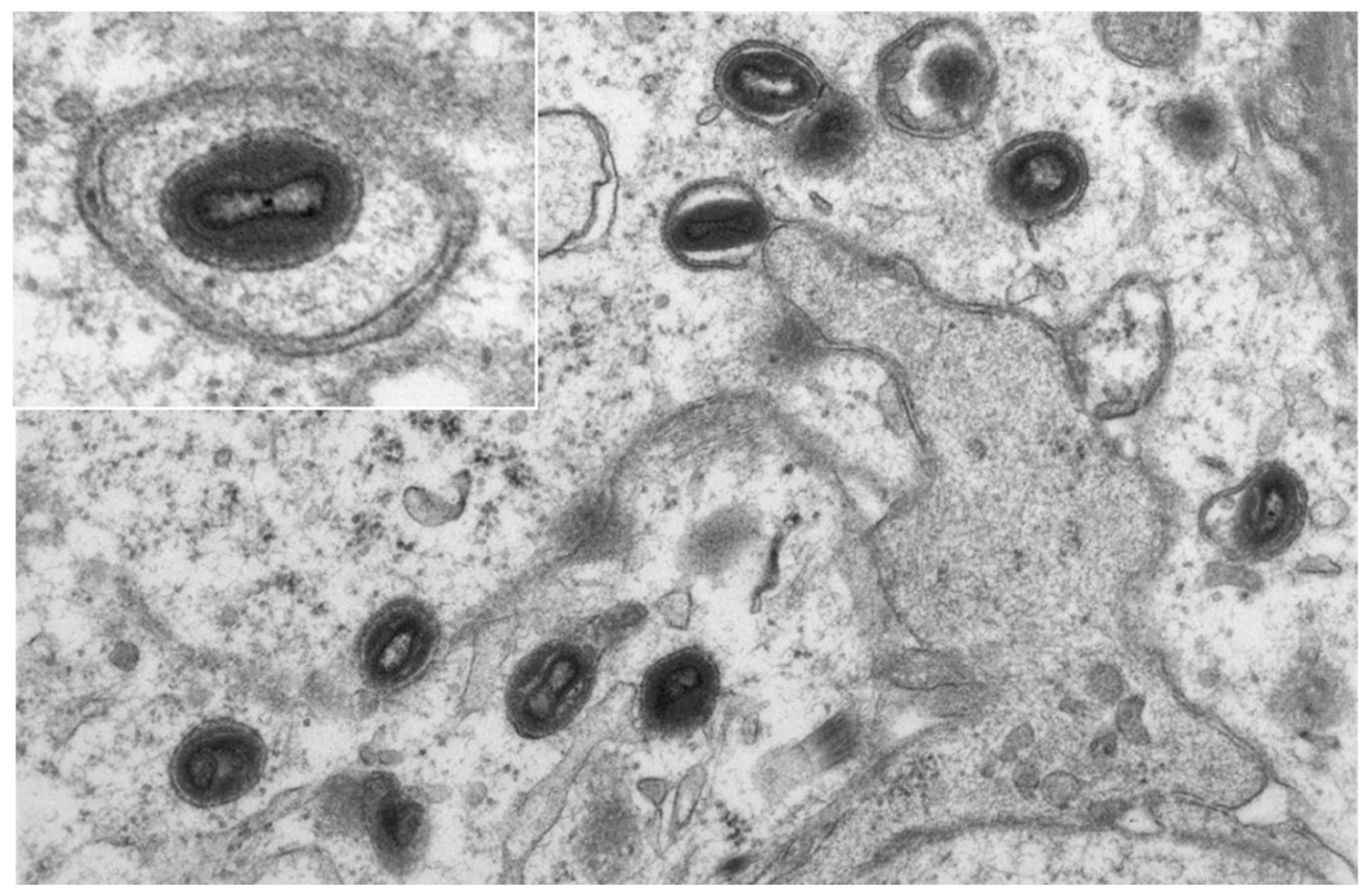Lives of Skin Lesions in Monkeypox: Histomorphological ...