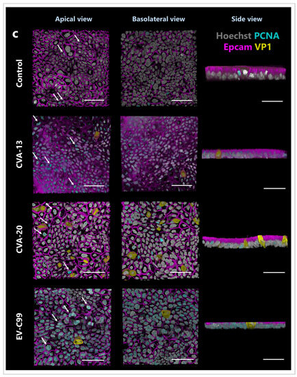 Viruses | Free Full-Text | Non-Polio Enterovirus C Replicate in Both ...