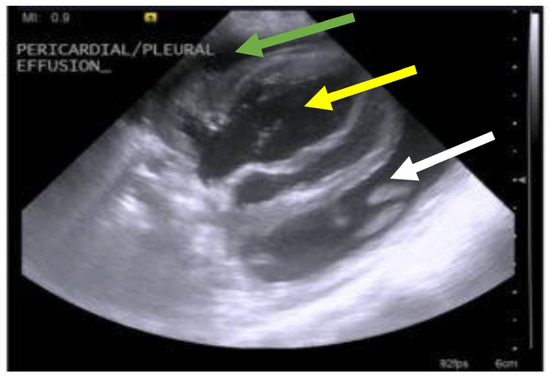 Viruses | Free Full-Text | Feline Infectious Peritonitis: European ...