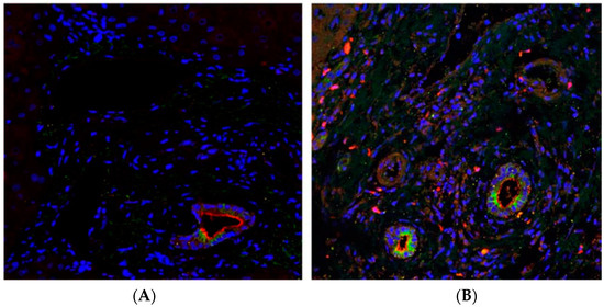 Molecular Imaging of ACE2 Expression in Infectious Disease and Cancer