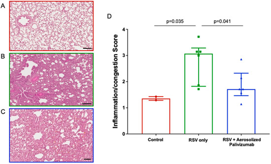 Aerosol Delivery of Palivizumab in a Neonatal Lamb Model of Respiratory ...